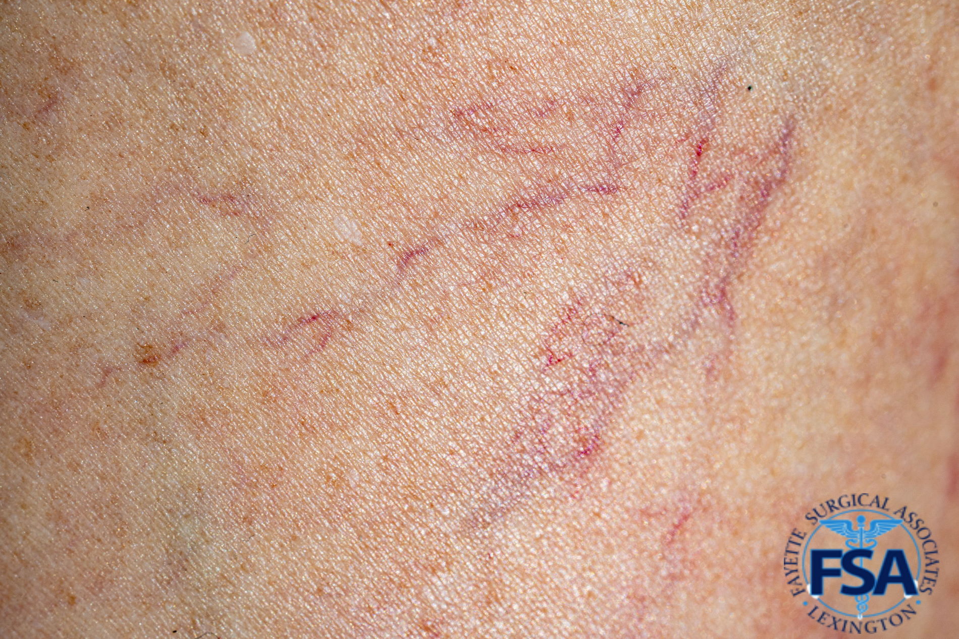 Fayette Surgical Associates