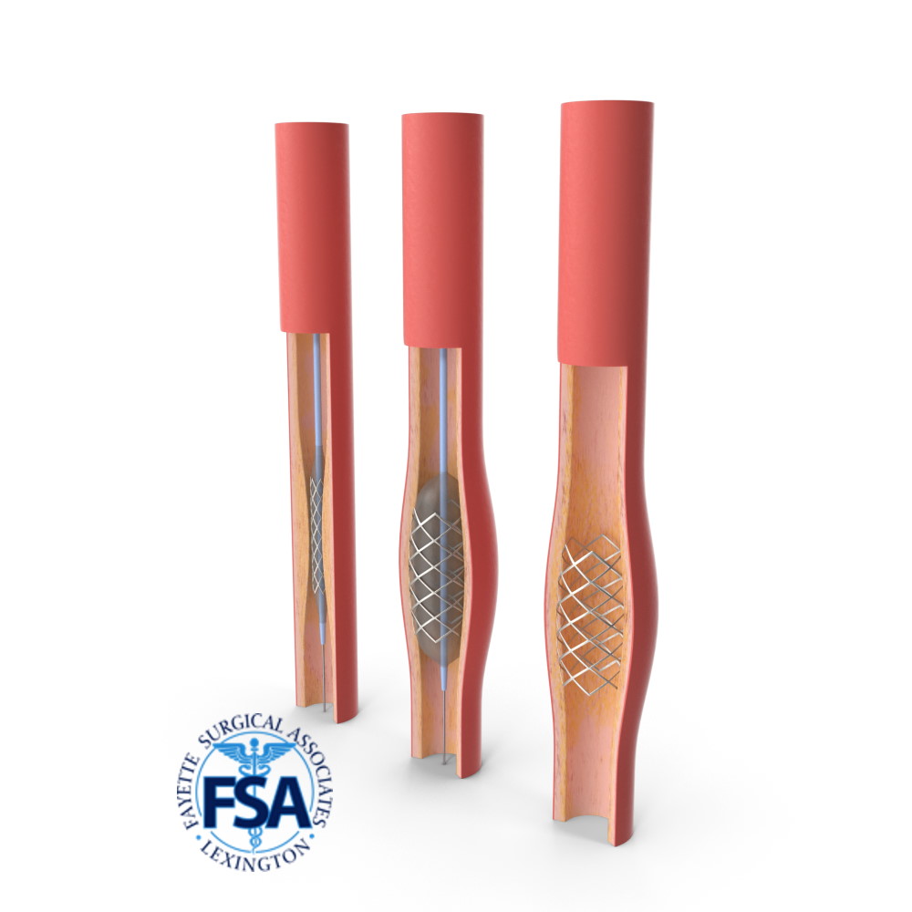 Fayette Surgical Associates